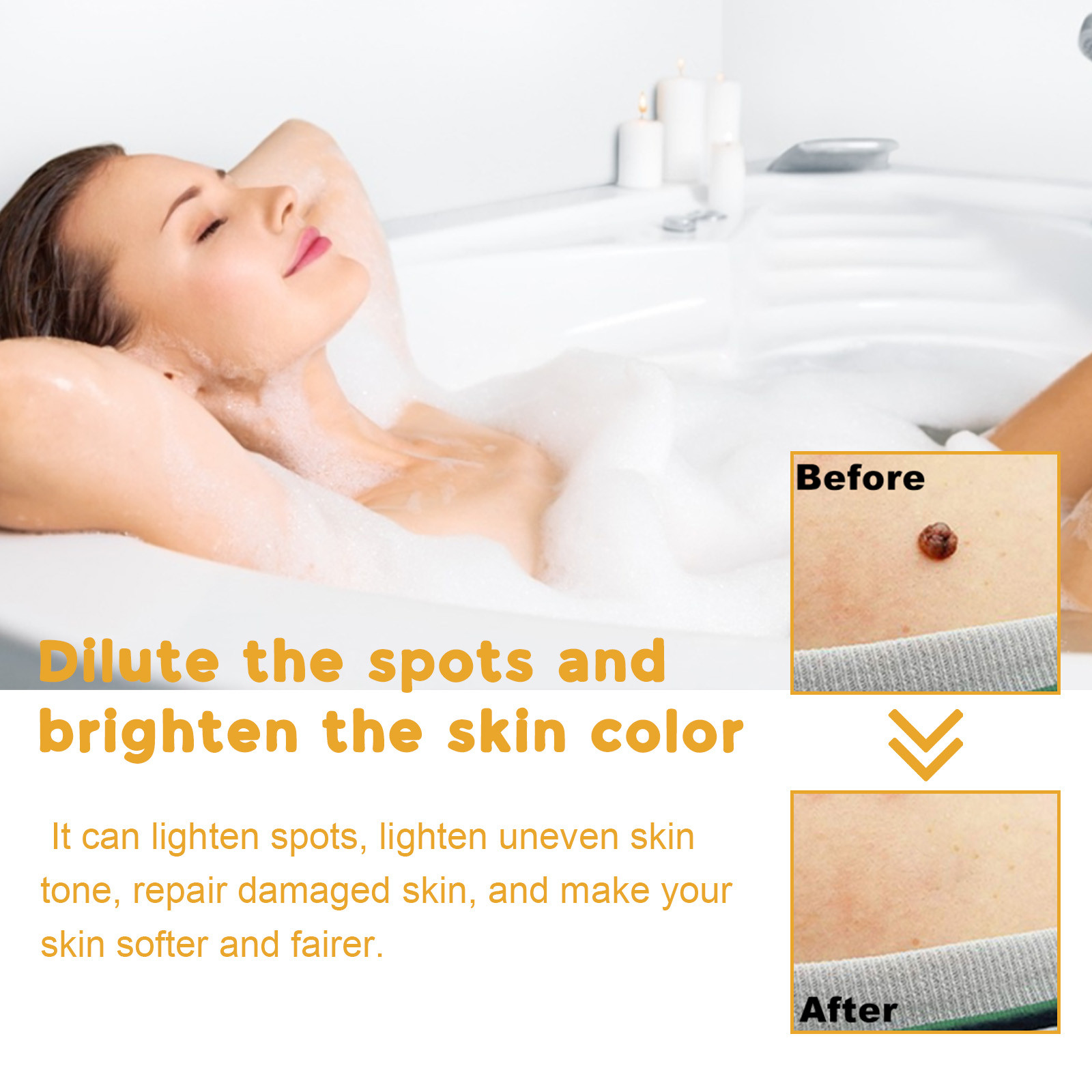 Leiity 20ml Spray Spray For Skin Tags Or Warts The Effectiveness Of Is ...